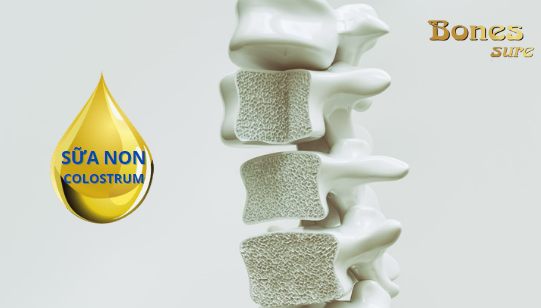 Bones Sure - Bí mật công thức sữa non xương khớp thế hệ mới